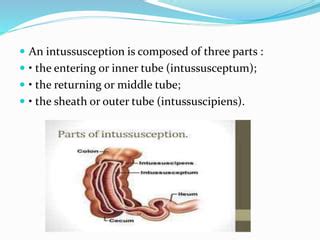 Intestinal Obstruction Pptx