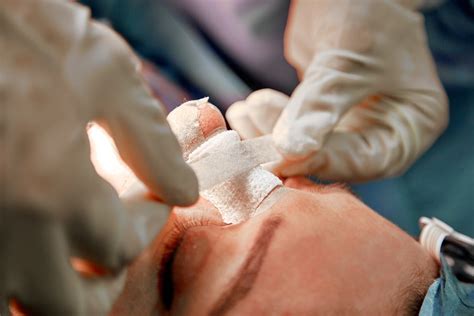 Nose Job Surgery Bandage