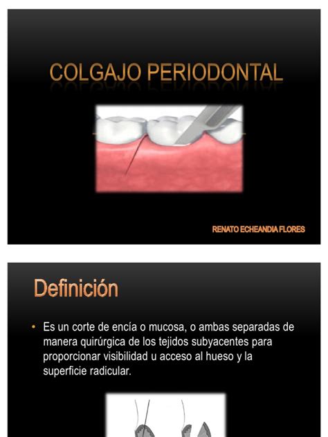Colgajo Periodontal Pdf