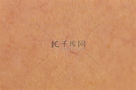 皮肤病，皮肤，静脉，斑点高清摄影大图 千库网