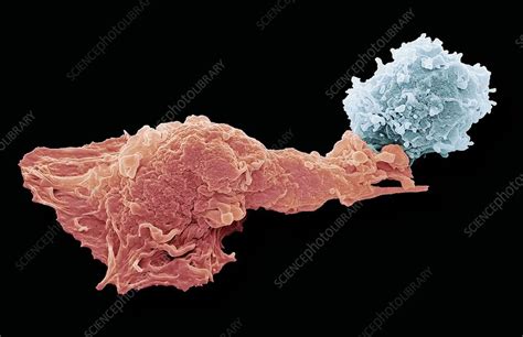 Antigen Presentation Sem Stock Image C0243640 Science Photo Library