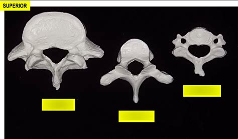 Lab 1 Station 4 Identifying Vertebrae Superior Diagram Quizlet