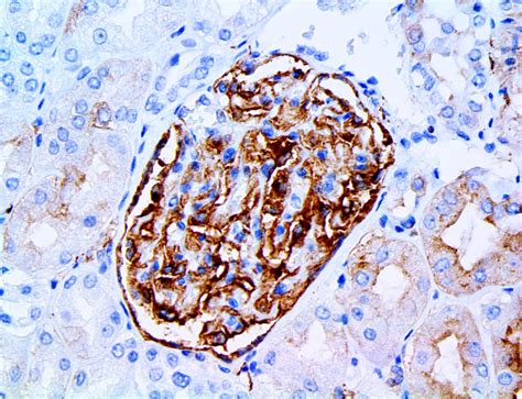 Cd61 Antibody Ep65 Bio Sb
