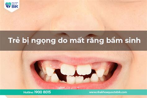 Causes of congenital tooth loss and effective treatment Nha Khoa Quốc Tế BIK