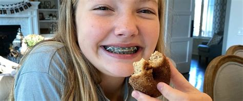 What To Eat In The First 3 Days Of Braces
