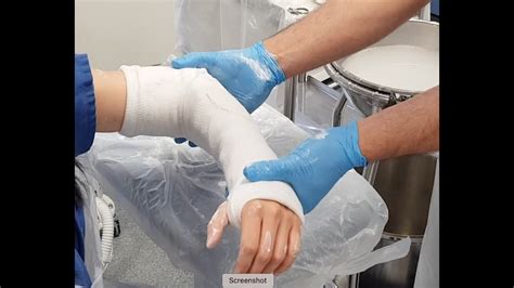 How To Apply An Above Elbow Backslab Orthocycle Foundation Youtube