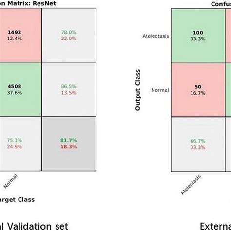 The Auc Diagram Of The Internal And External Validation Sets Download Scientific Diagram
