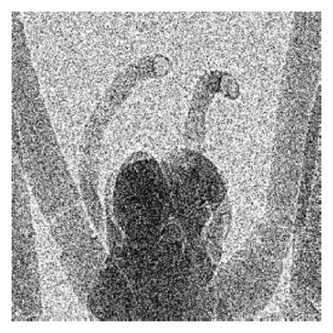 the denoising results of x ray spider image with σ 25 α 0 8 and