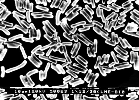 Micrograph Of Bacillus Subtilis By Sem Download Scientific Diagram