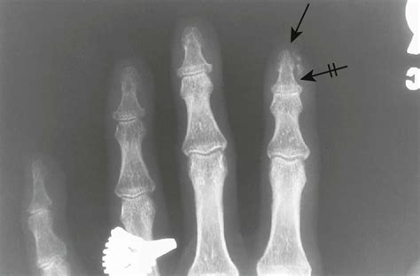 Extremity Patterns Radiology Key