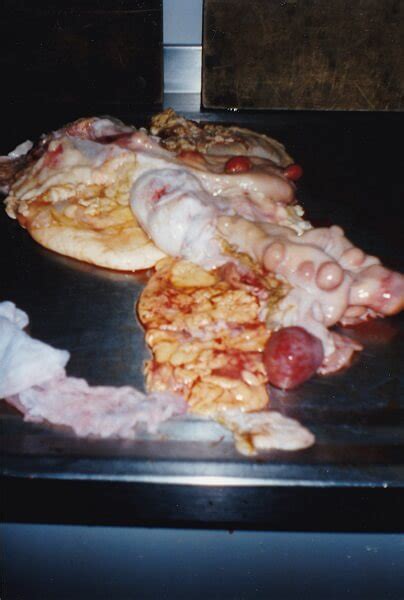 Multicentric Lymphosarcoma Lymph Nodes In Cows Bovis Vetlexicon