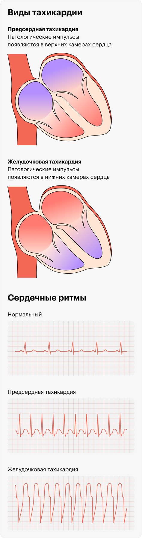 9 важных вопросов аритмологу