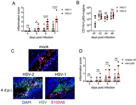 A Sustained Type I Ifn Neutrophil Il 18 Axis Drives 41 Off