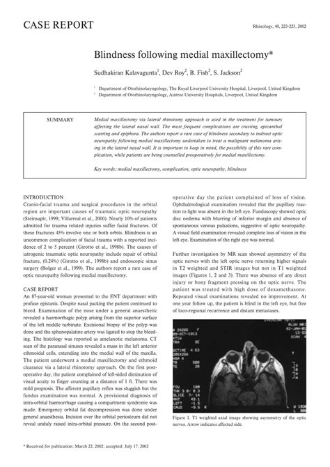 Pdf Blindness Following Medial Maxillectomy