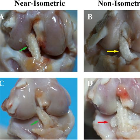 Macroscopic Observations Of Synovial Tissue Coverage Green Arrow