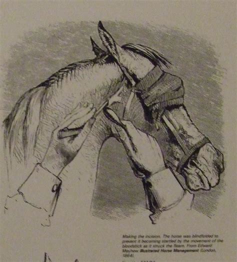 Diagram In The Science Museum London Demonstrating The Bleeding Of A