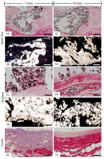 Materials Special Issue Contemporary Endodontic Materials