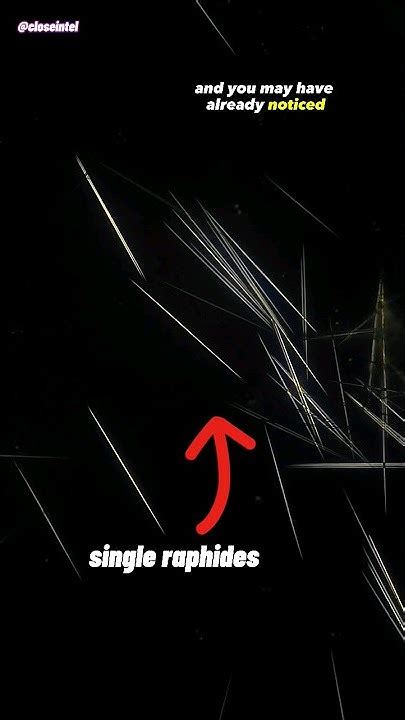 Kiwi Under Microscope Raphides Youtube