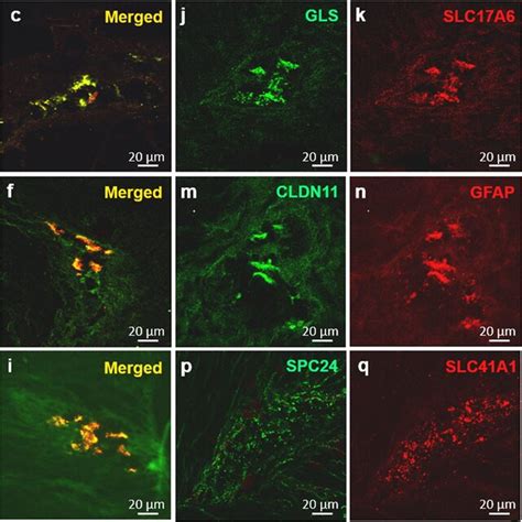 Validation Of Discriminatory Marker Genes For Major Classes Of Enteric Download Scientific