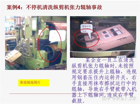 机械伤害事故案例图集合集 知乎