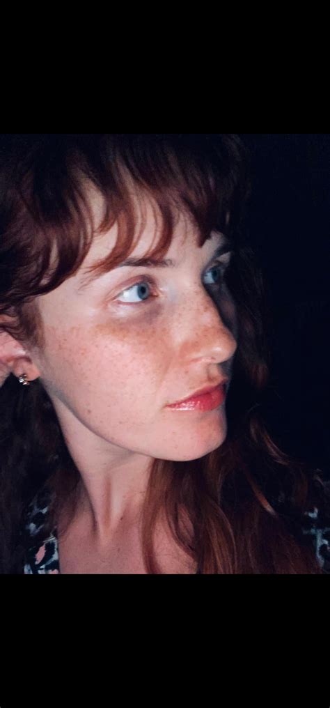 The More Freckles The Better True R Freckledgirls
