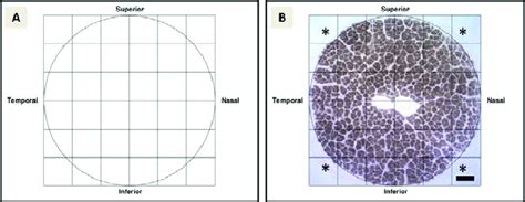 A Schematic Illustration Of The Optic Nerve Sampling Methodology The