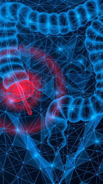 Apendicita Despre Simptome și Cum O Deosebești De Alte Afecțiuni