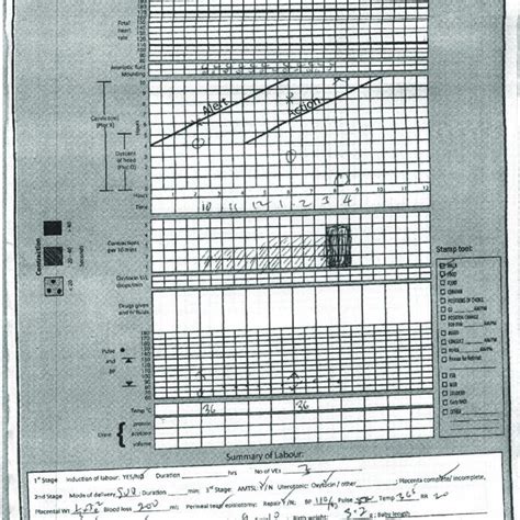Pdf Effectiveness Of An Electronic Partogram A Mixed Method Quasi