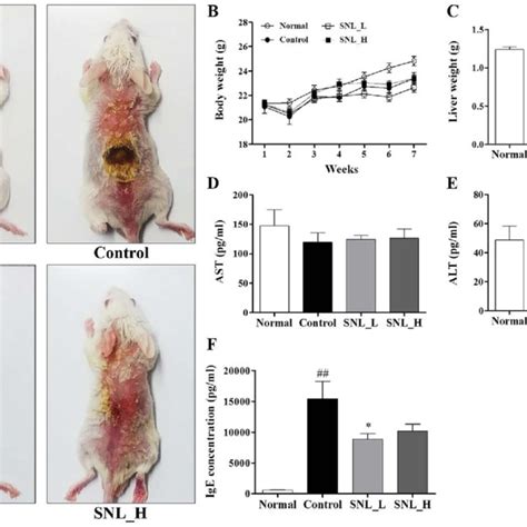 Experimental Procedure Of The Model Of Dncb Induced Atopic Dermatitis Download Scientific