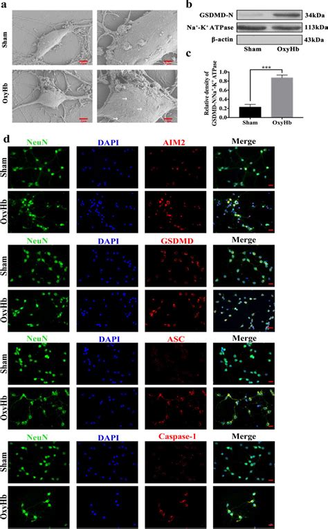 Pyroptosis In Primary Cortical Neurons A Representative Scanning