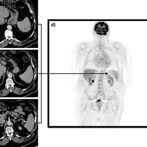 Maria Marples Consultant In Medical Oncology Bm Bch Phd Frcp
