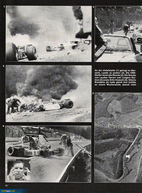 Niki Lauda Burns Accident