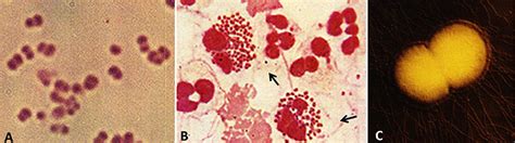 Neisseria Gonorrhoeae Microscope