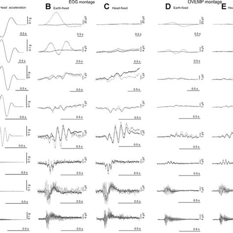 Stimulus Waveforms Vs Response Signals From Electrooculogram Eog And