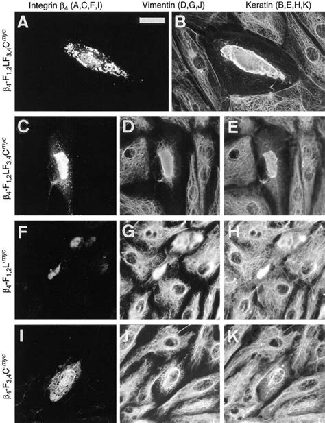 Collapse Of If Network Arrays In Ptk2 Cells Ectopically Expressing
