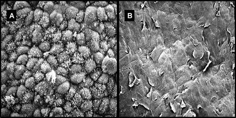 Structure And Function Of Intercellular Junctions In Human Cervical And