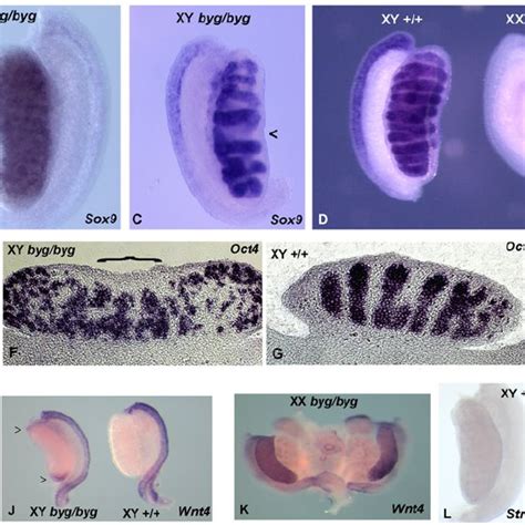 Pdf Loss Of Mitogen Activated Protein Kinase Kinase Kinase 4 Map3k4