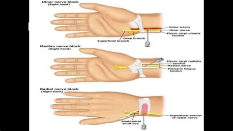 Peripheral Nerve Blockankle Blockwrist Block Digital Block