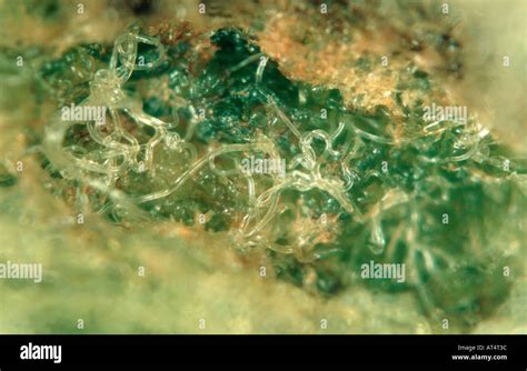 Stem Bulb Eelworm Ditylenchus Dipsaci In Swollen Field Bean Stem Stock