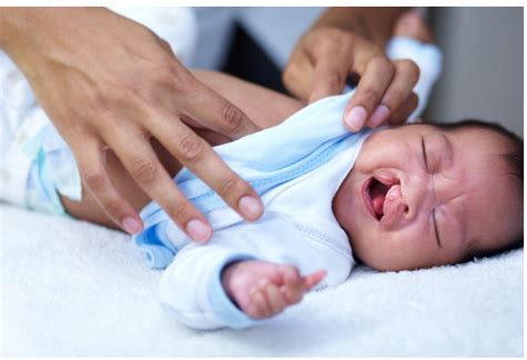 Sequenza Di Pierre Robin Ba Bi S Odv