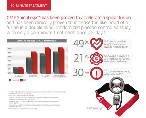 Cmf Bone Growth Stimulator Flexus Medical