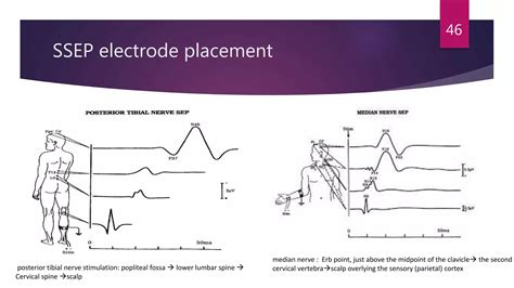 Neuromonitoring Pptx