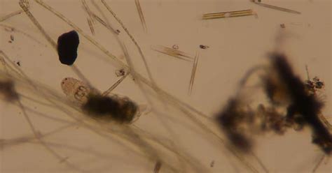 Unidentified Microbe From Agricultural Irrigation Ditch Algae Boulder Colorado Album On Imgur