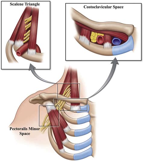 Anatomy And Embryology Of The Thoracic Outlet Thoracic Surgery Clinics
