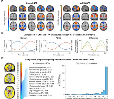 Spatiotemporal Comparison Of The Control And Adhd Qpps A Areas With Download Scientific