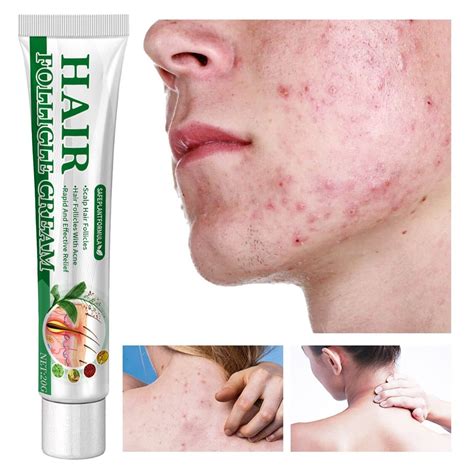 New Listingkorean Ning Skin Care Products Skin Care Hair Natural Face Wash For Oily Skin U