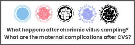 The Chorionic Villus Sampling Side Effects