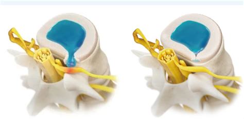 News Case Sharing Pingliang Citys First Fully Visualized Spinal