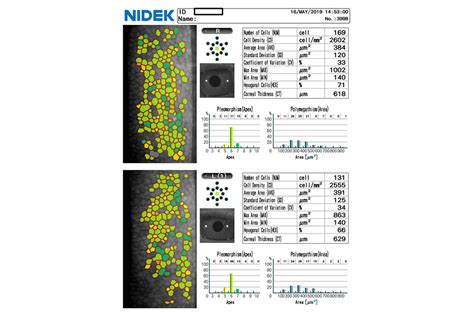 Microscopia Especular