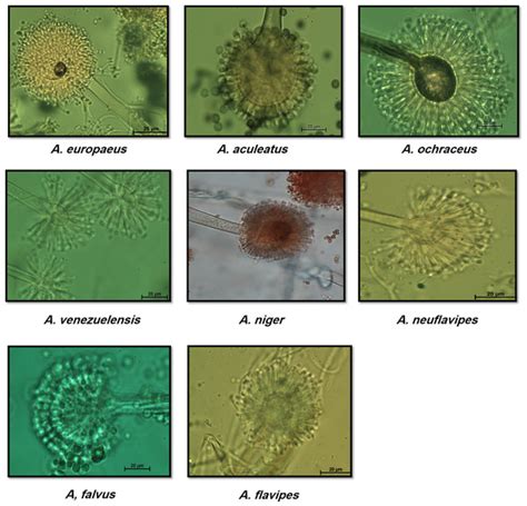 Identification And Biodiversity Patterns Of Aspergillus Species